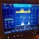 CARESCAPE R860 | Critical Care Ventilators