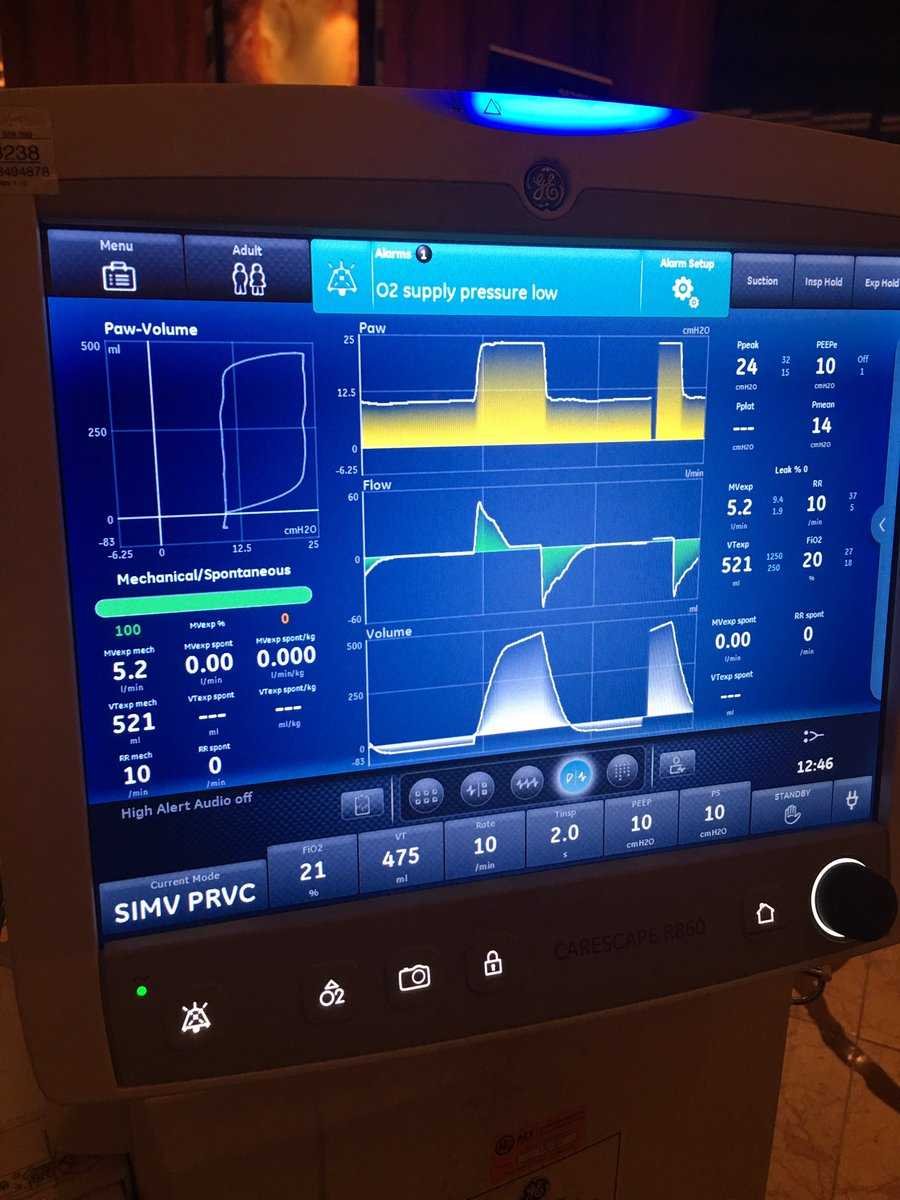 CARESCAPE R860 | Critical Care Ventilators