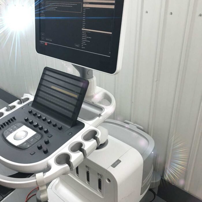 Philips EPIQ 5 Ultrasound Machine | Marcroft Medical