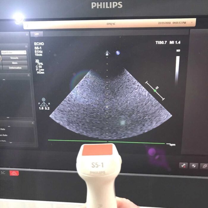 Philips EPIQ 5 Ultrasound Machine | Marcroft Medical