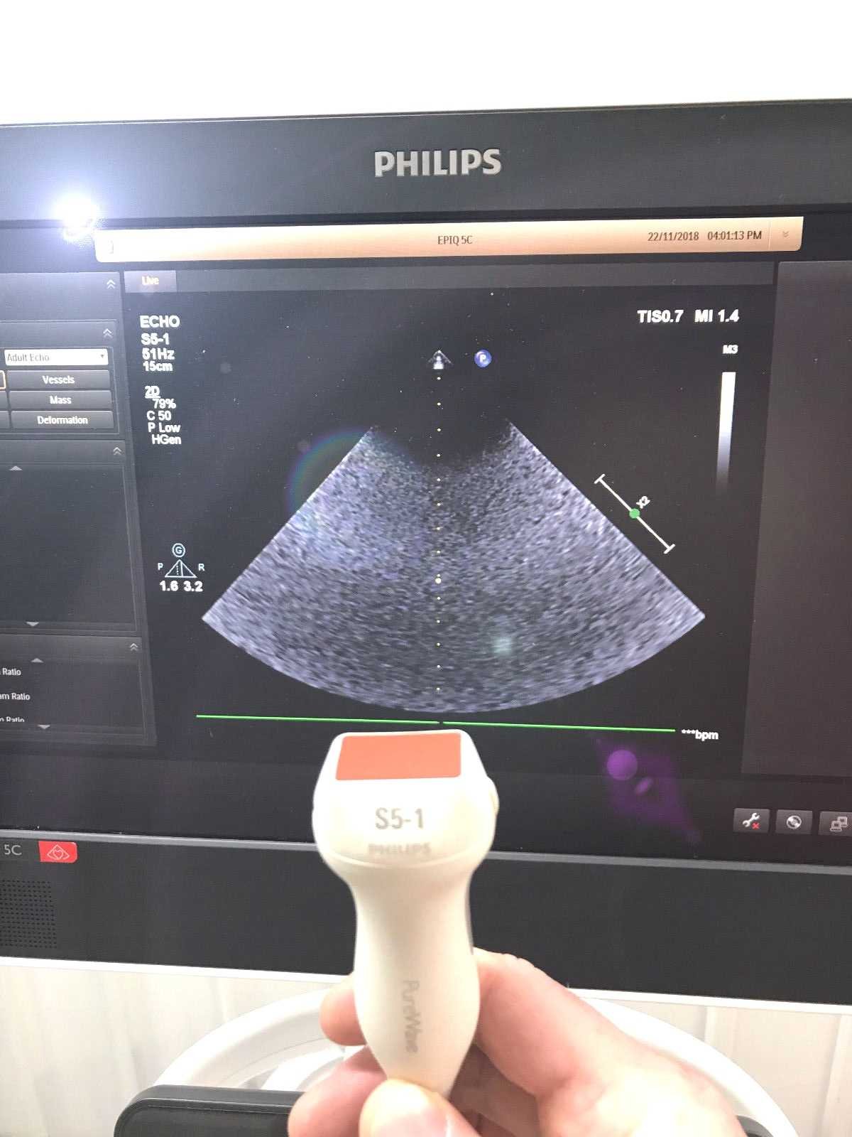 Philips EPIQ 5 Ultrasound Machine | Marcroft Medical