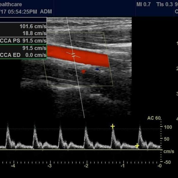 GE Logiq E9 with XDclear Ultrasound System | Marcroft Medical