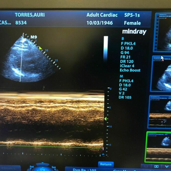 Mindray M9 | Premium portable Ultrasound | Marcroft Medical