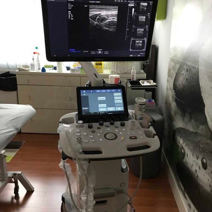 Samsung HS40 Ultrasound Machine | Marcroft Medical Next Generation in ...