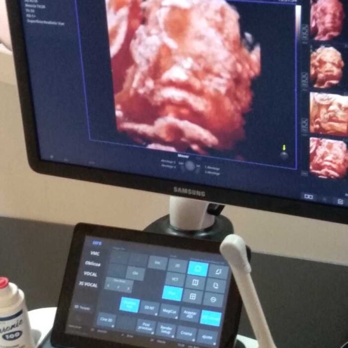 Samsung HS40 Ultrasound Machine | Marcroft Medical Next Generation in ...