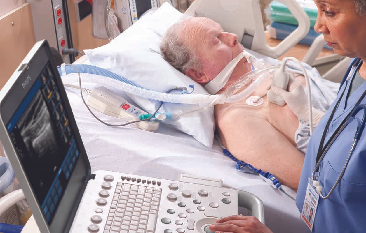 Philips CX50 General imaging ultrasound system | Marcroft Medical