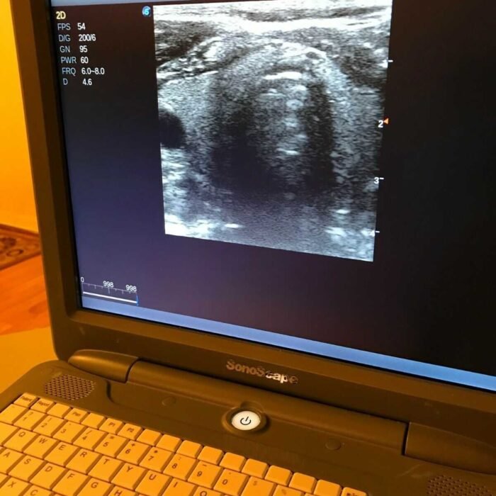 SonoScape S2 Ultrasound | Marcroft Medical