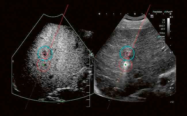 Canon Aplio i800 Diagnostic Ultrasound System | Marcroft Medical