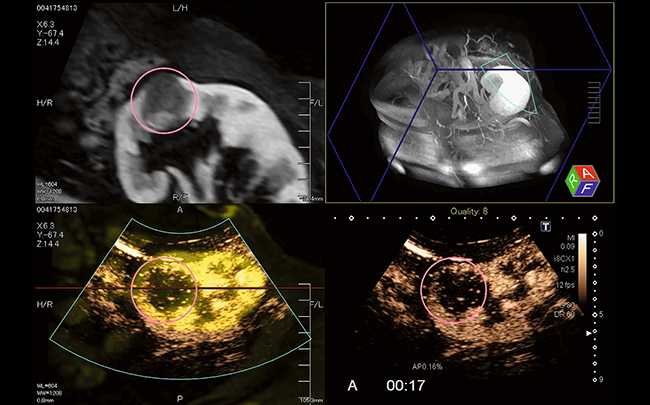 Canon Aplio i800 Diagnostic Ultrasound System | Marcroft Medical