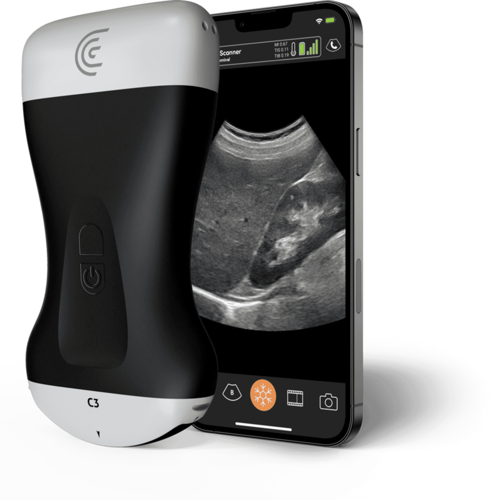 Clarius C3 HD3 Convex - USED | Marcroft Medical