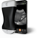 Clarius C3 HD3 Convex - USED | Marcroft Medical