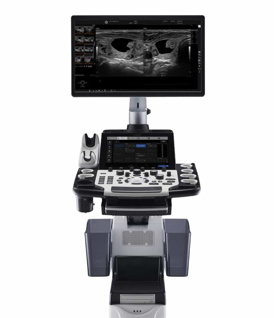 Buying Guide for Choosing a GE LOGIQ Ultrasound Machine | Marcroft Medical