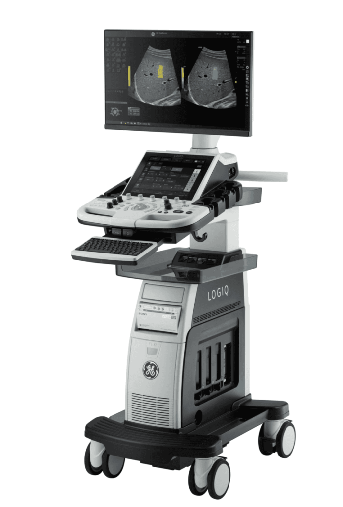 Buying Guide for Choosing a GE LOGIQ Ultrasound Machine | Marcroft Medical